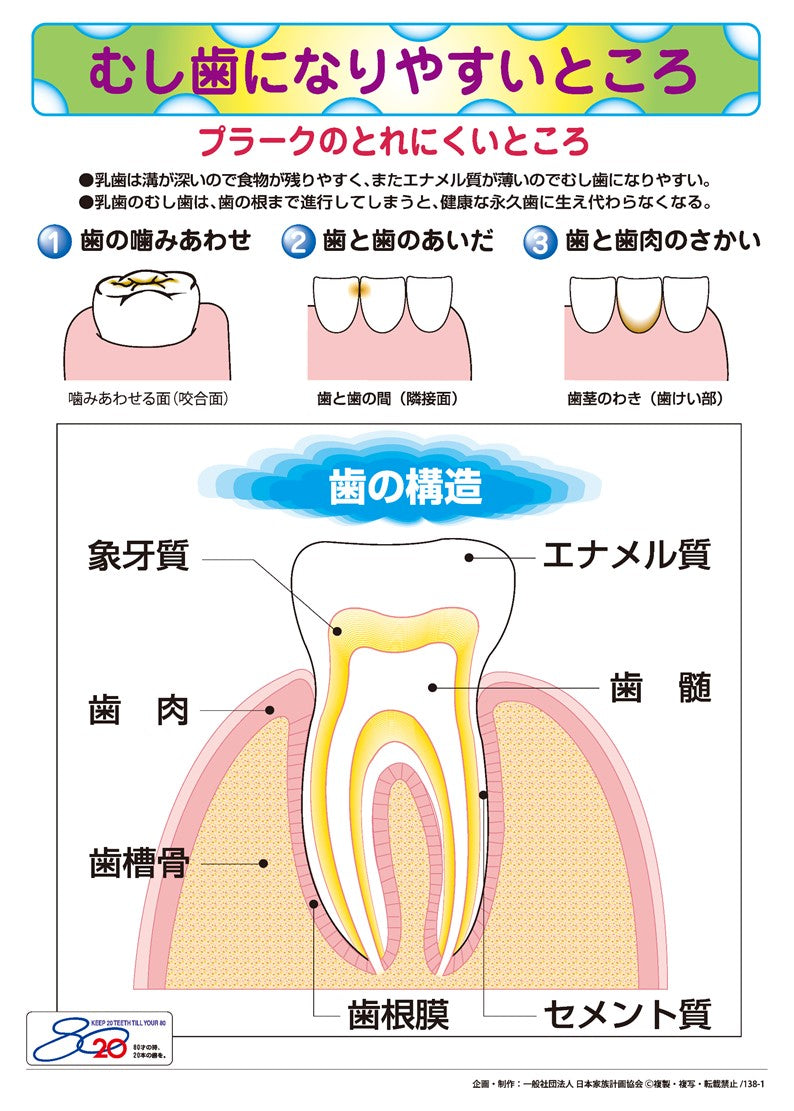 むし歯になりやすいところ – JFPA®オンラインショップ
