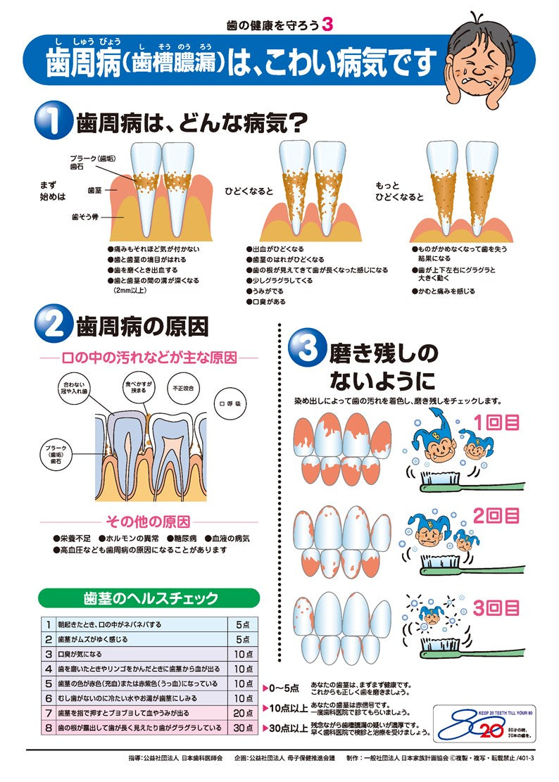 歯周病（歯槽膿漏）は、こわい病気です – JFPA®オンラインショップ