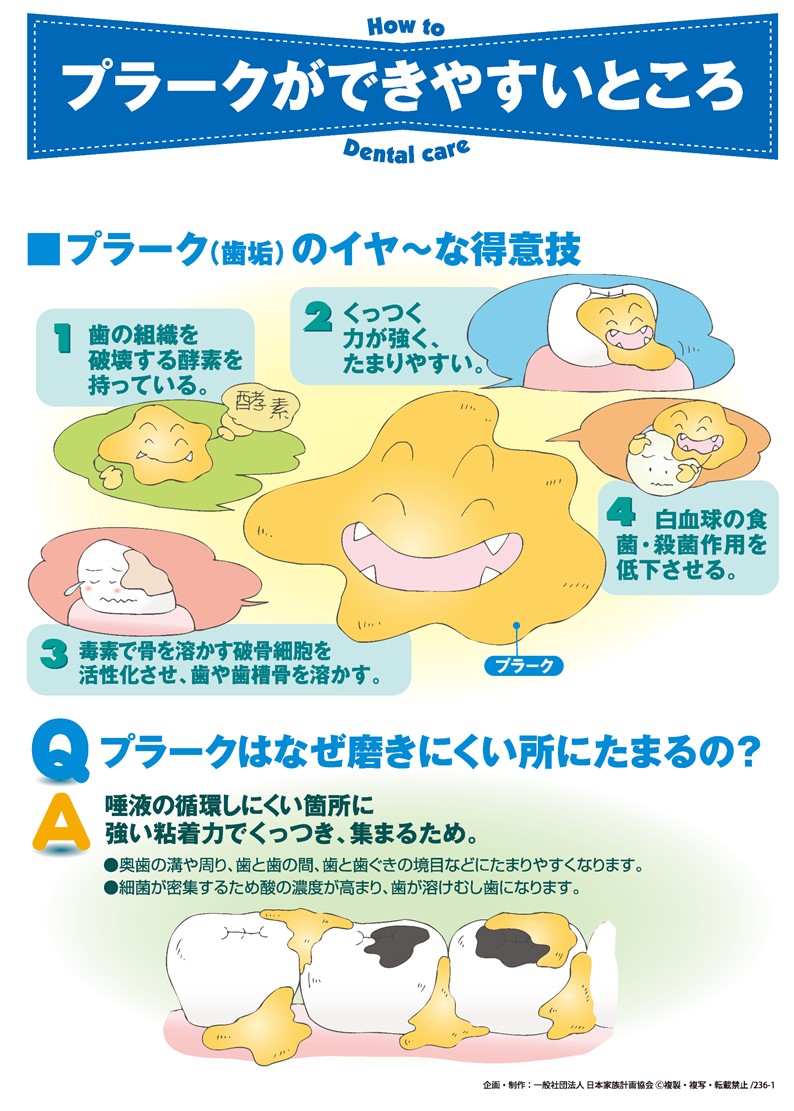 プラークができやすいところ – JFPA®オンラインショップ