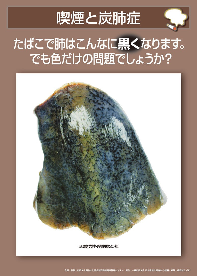 喫煙と炭肺症 – JFPA®オンラインショップ