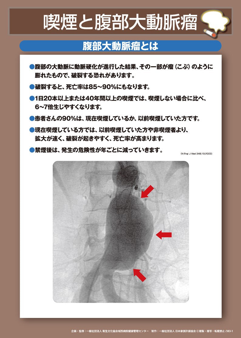 喫煙と腹部大動脈瘤 – JFPA®オンラインショップ