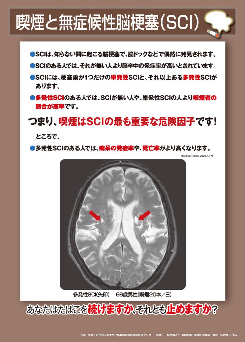 喫煙と無症候性脳梗塞（SCI） – JFPA®オンラインショップ