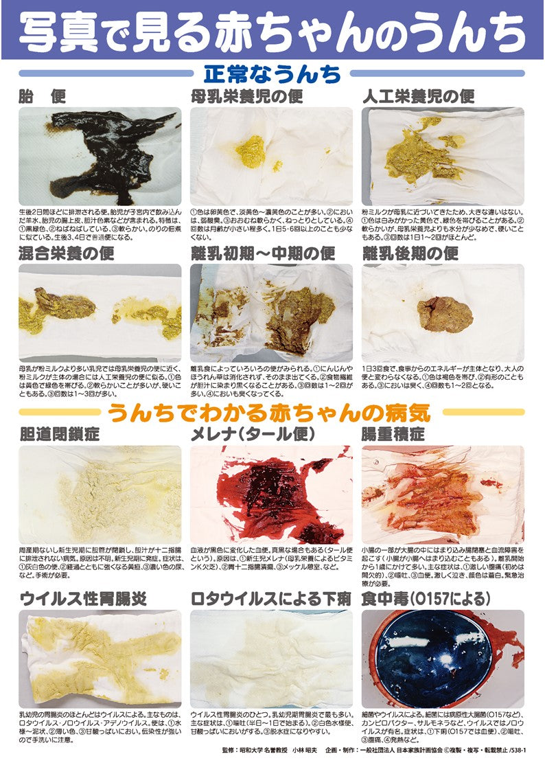 写真で見る赤ちゃんのうんち – JFPA®オンラインショップ