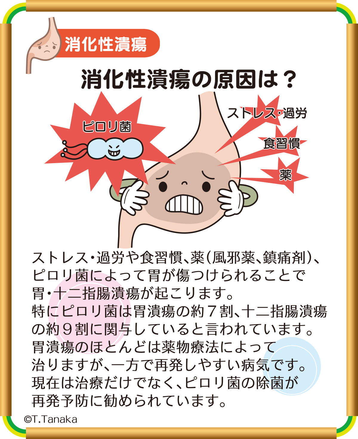 B-227 消化性潰瘍の原因は？ – JFPA®オンラインショップ