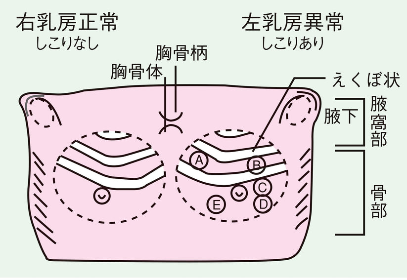 乳がん触診モデル精密型 – JFPA®オンラインショップ